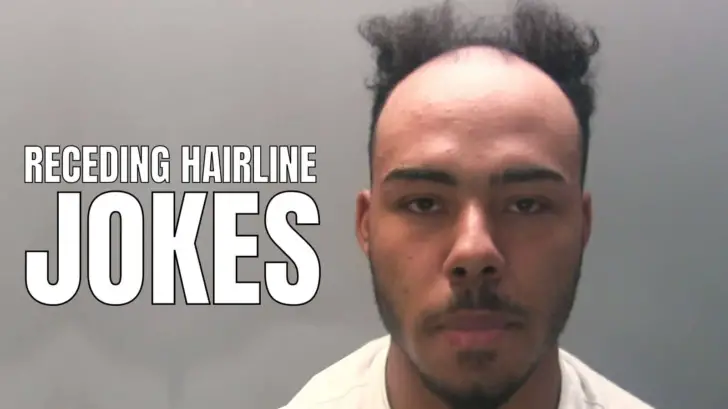 30 Funny Hairline Jokes That Refuse To Grow Up